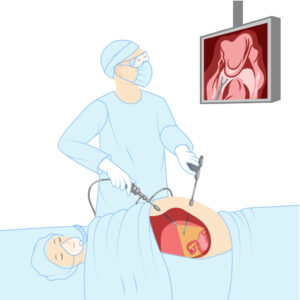 Minimally Invasive Surgery At Medicsi - Medicsi